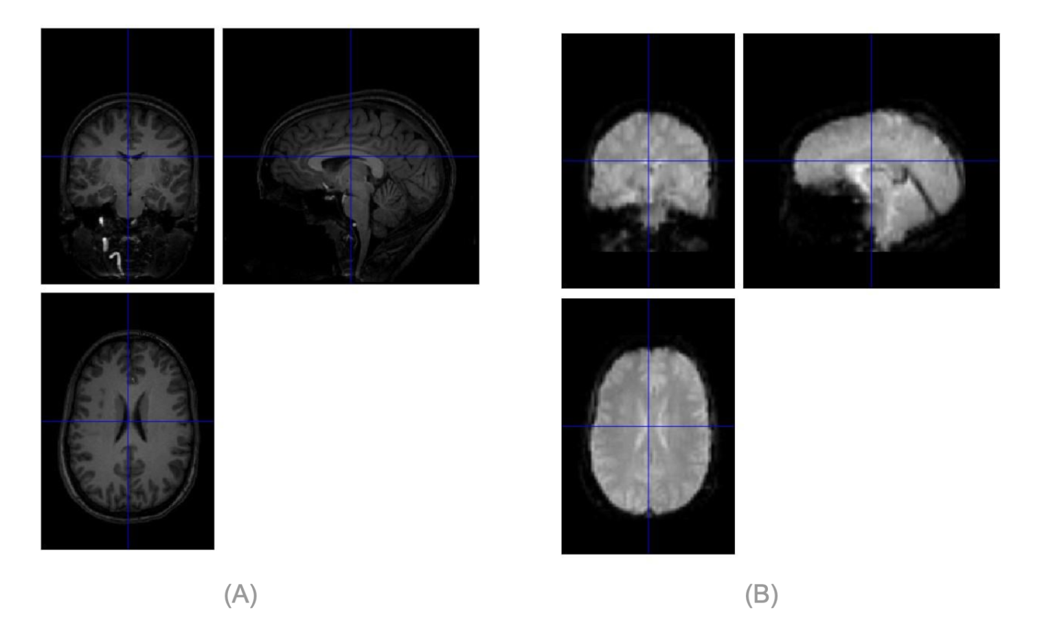 Exploring Brain Mapping and Neuroimaging: A Comprehensive Journey into ...